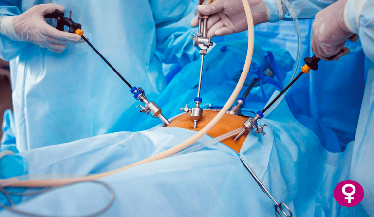 Laparoscopia exploradora ginecológica en la Clínica Quirúrgica OncoGyn