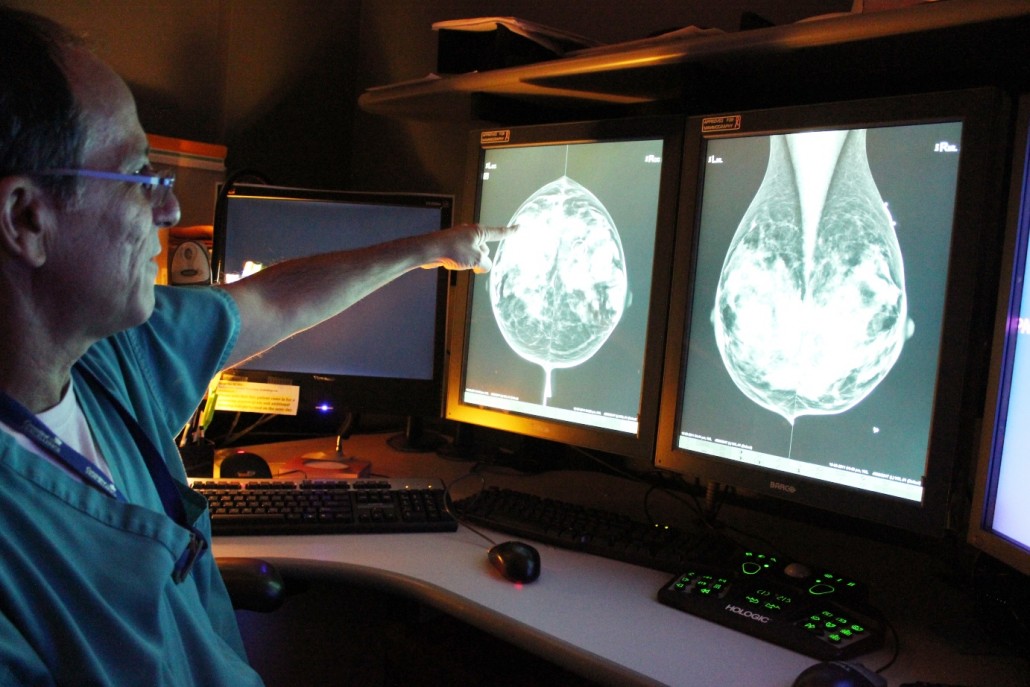 mamografia4[1] - Chequeos de ginecología preventiva | Oncogyn