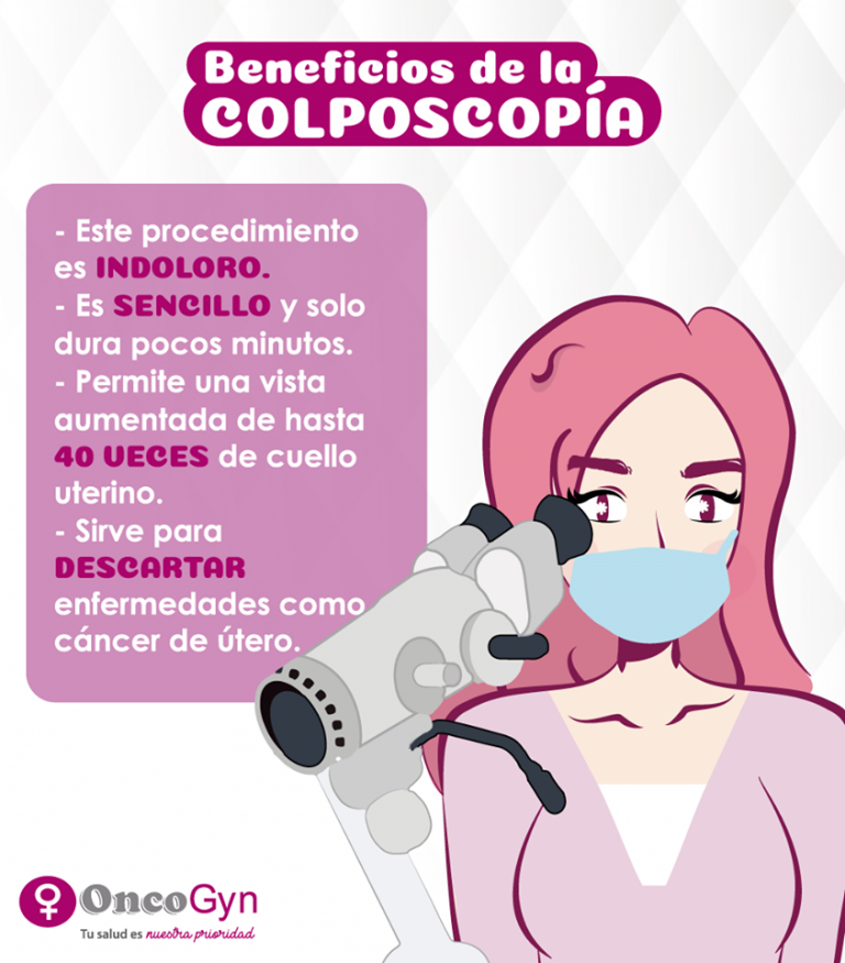 colposcopia - OncoGyn