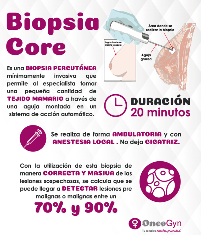 Biopsia Core en lesiones mamarias para la detección de cáncer de mama ...