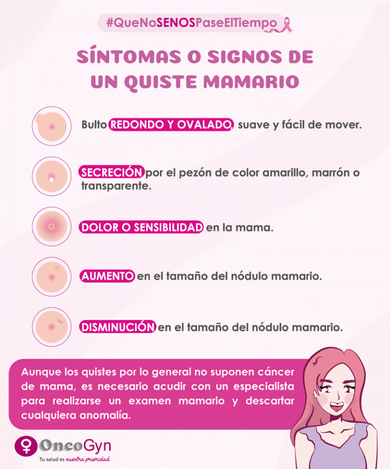 Quistes mamarios ¿tengo algún riesgo de sufrir cáncer de mama?
